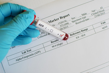 What Is An AFP Test And How To Interpret The Test Result? | Tesla Scans