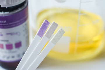 Significance of Urine Routine Test in the Diagnosis of UTIs